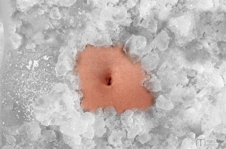 Criolipólise Frio e Adipócitos – Clínica Manuela Rebelo
